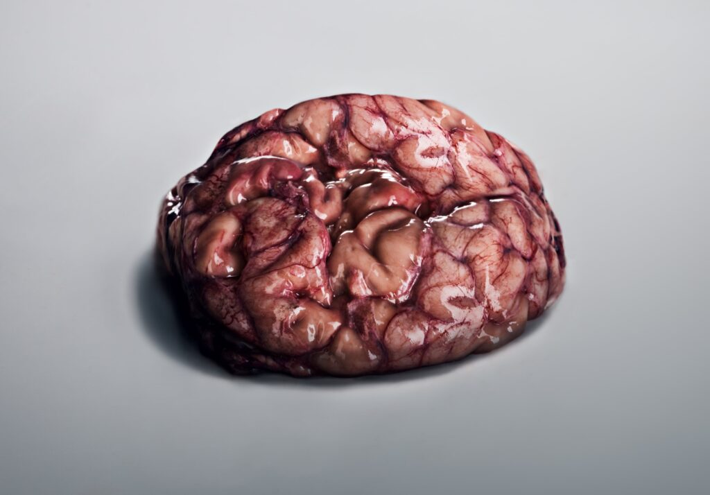 What is Wet Brain Behavior? | Renewal Health Group